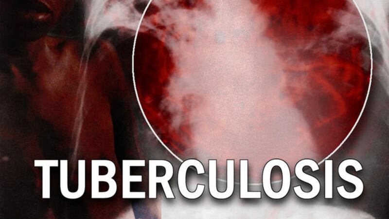 Los casos de tuberculosis en EE.UU. van en aumento: CDC revela ... Los casos de tuberculosis en EE.UU. van en aumento: CDC revela ...